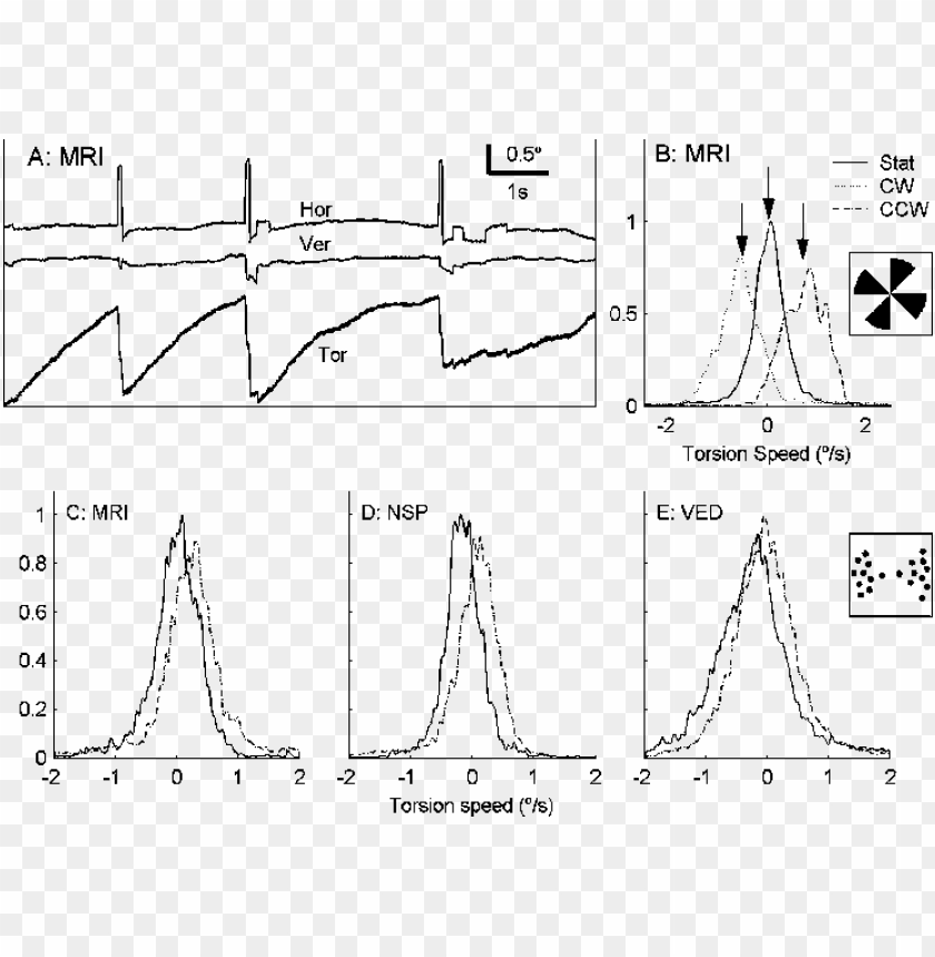 Free download | HD PNG a e eye movements when viewing rotation diagram ...