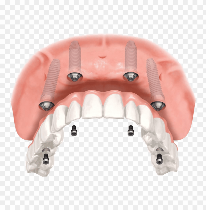 Free download | HD PNG all on 4 upper PNG transparent with Clear ...