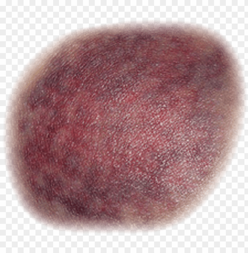 Free download | HD PNG best of boston background psd detail bruise ...