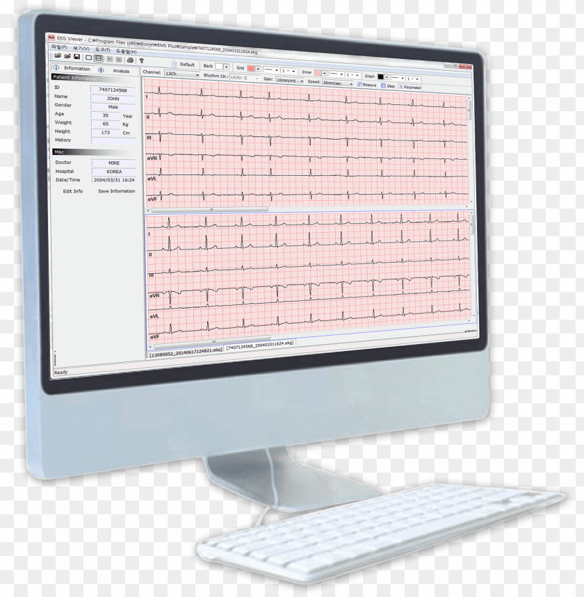 Free download | HD PNG bms plus bionet ekgecgspirometer software ...