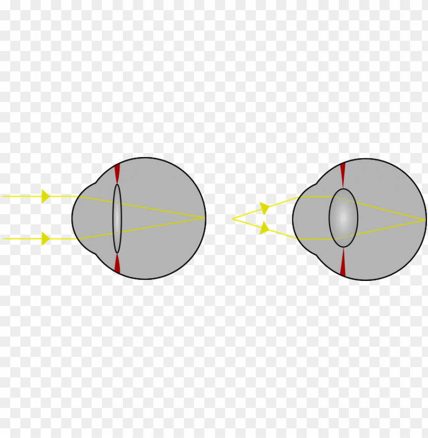 Free download | HD PNG eye lens accommodation PNG transparent with ...