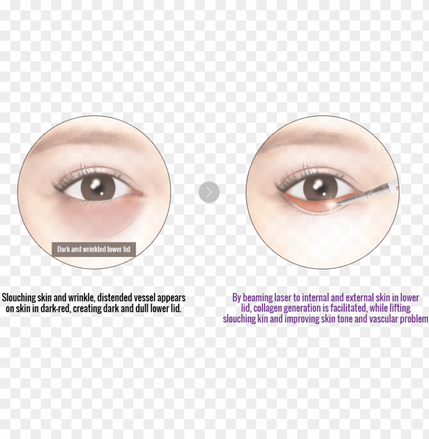 Free download | HD PNG eyelash extensions PNG transparent with Clear ...