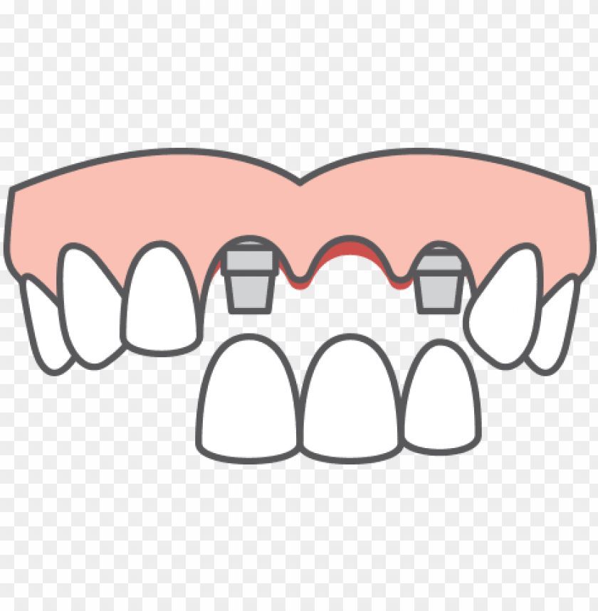 Free download | HD PNG multiple tooth dental implants icon denture icon ...