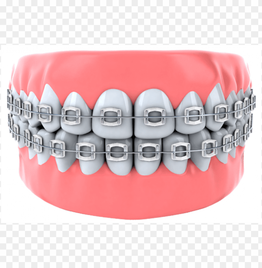 Free download | HD PNG teeth smoke braces color PNG transparent with ...
