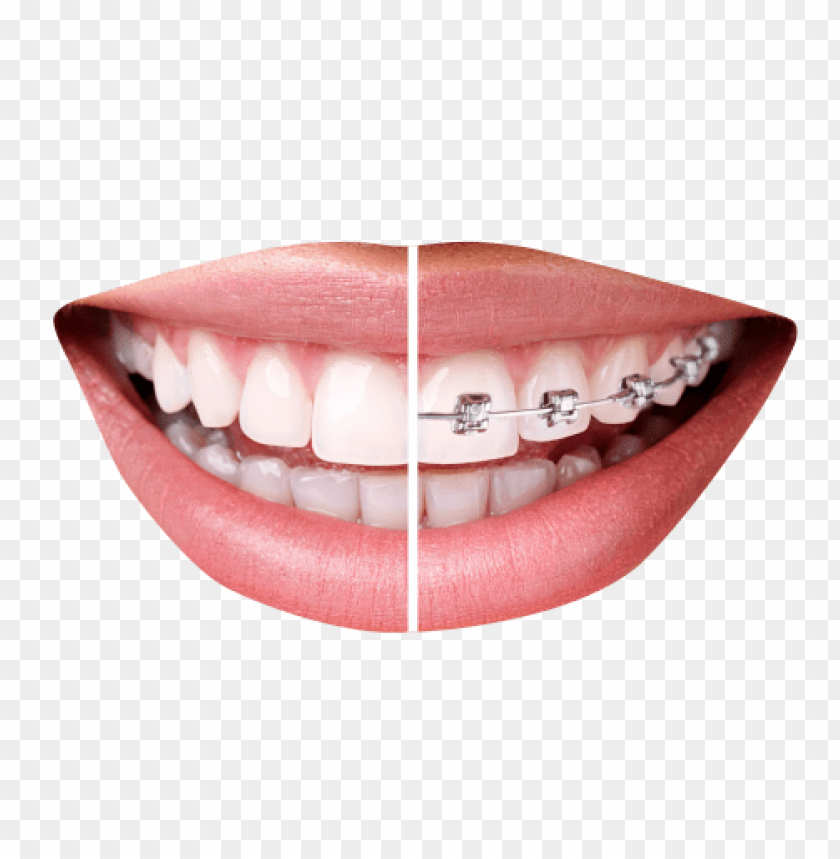 Free download | HD PNG tooth png PNG transparent with Clear Background ...