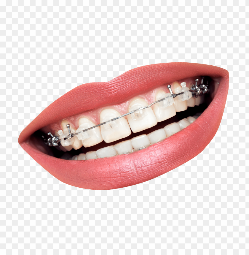 Free download | HD PNG tooth png PNG transparent with Clear Background ...