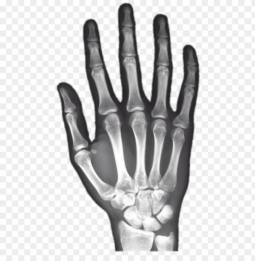 Free download | HD PNG x ray of hand PNG transparent with Clear ...